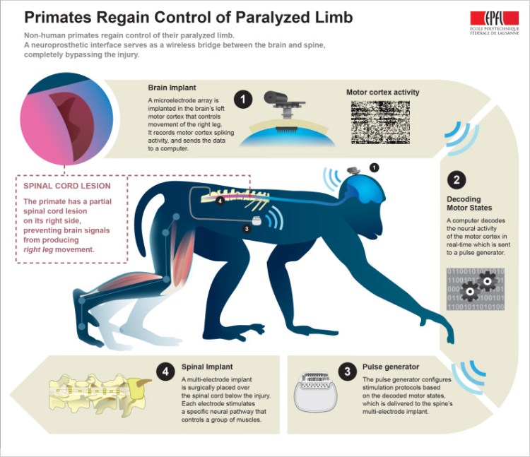 New Device Used in Monkeys Sparks Hope of Paralysis Cure - InsideHook