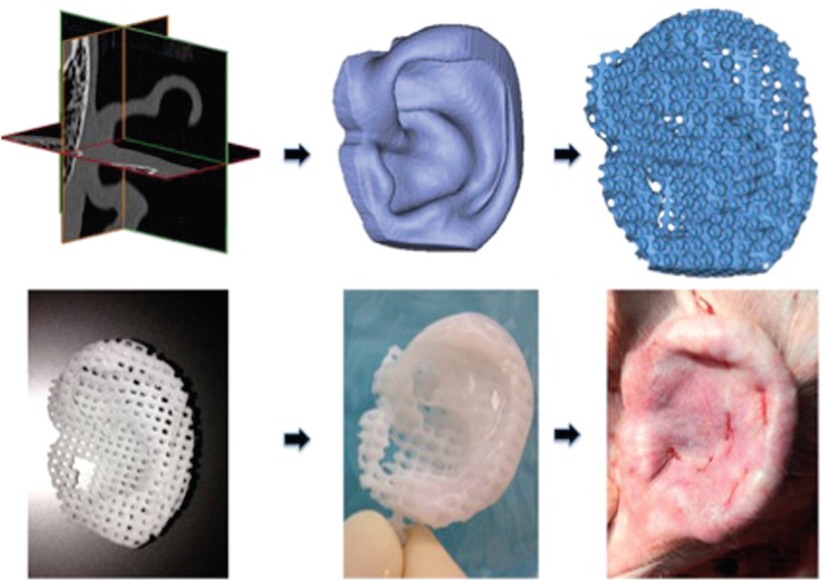 3D-Printing Used to Make Body Parts to Help Doctors Practice for ...