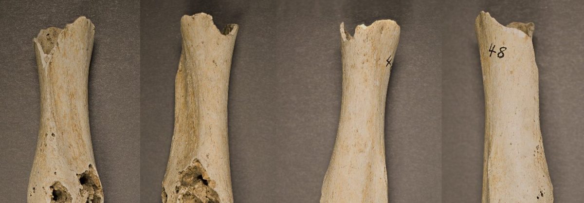 Remains of Oldest-Known Cancer Victim in Central America Discovered ...