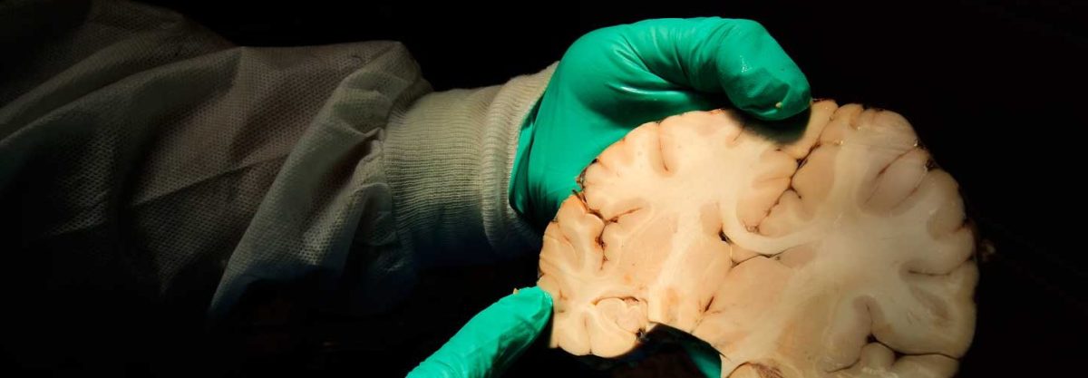 Study Finds CTE in 110 of 111 Former NFL Players' Brains - InsideHook