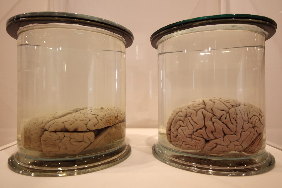 Hot New Silicon Valley Trend: Having Your Brain Preserved Forever ...