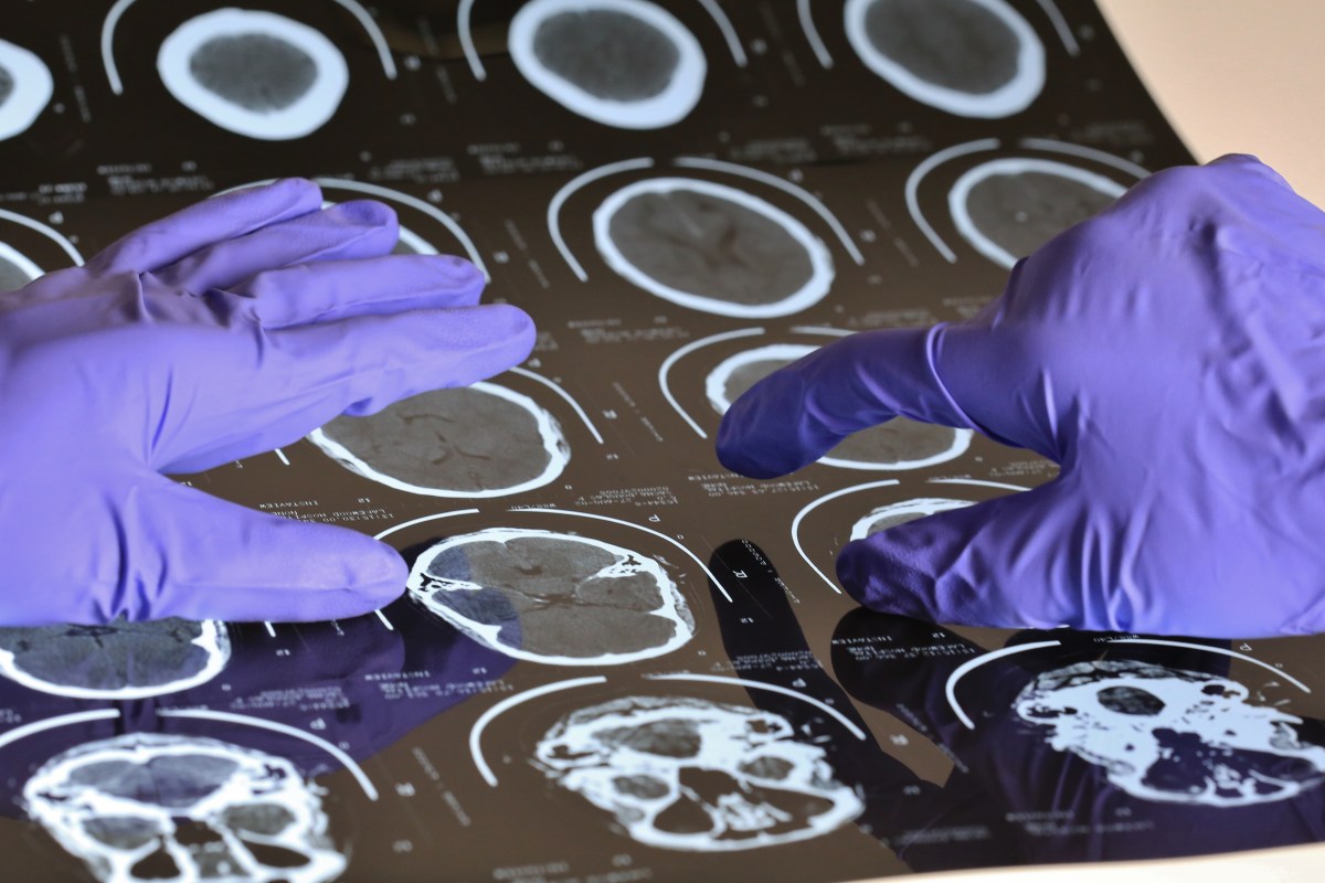 What Brain Imaging Is Teaching Us About the Neuroscience of Pain ...