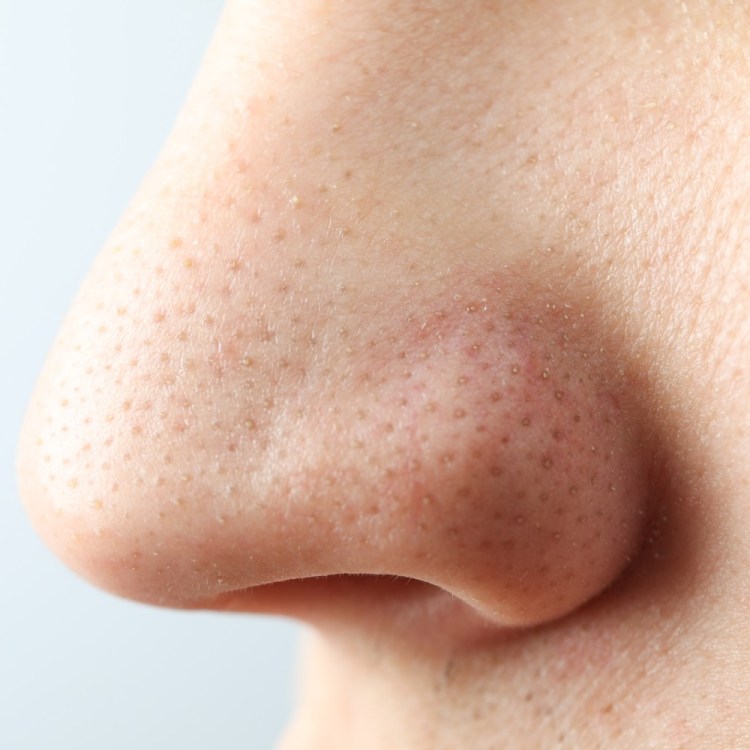 An Alternative Way to Keep a Running Streak Going - InsideHook