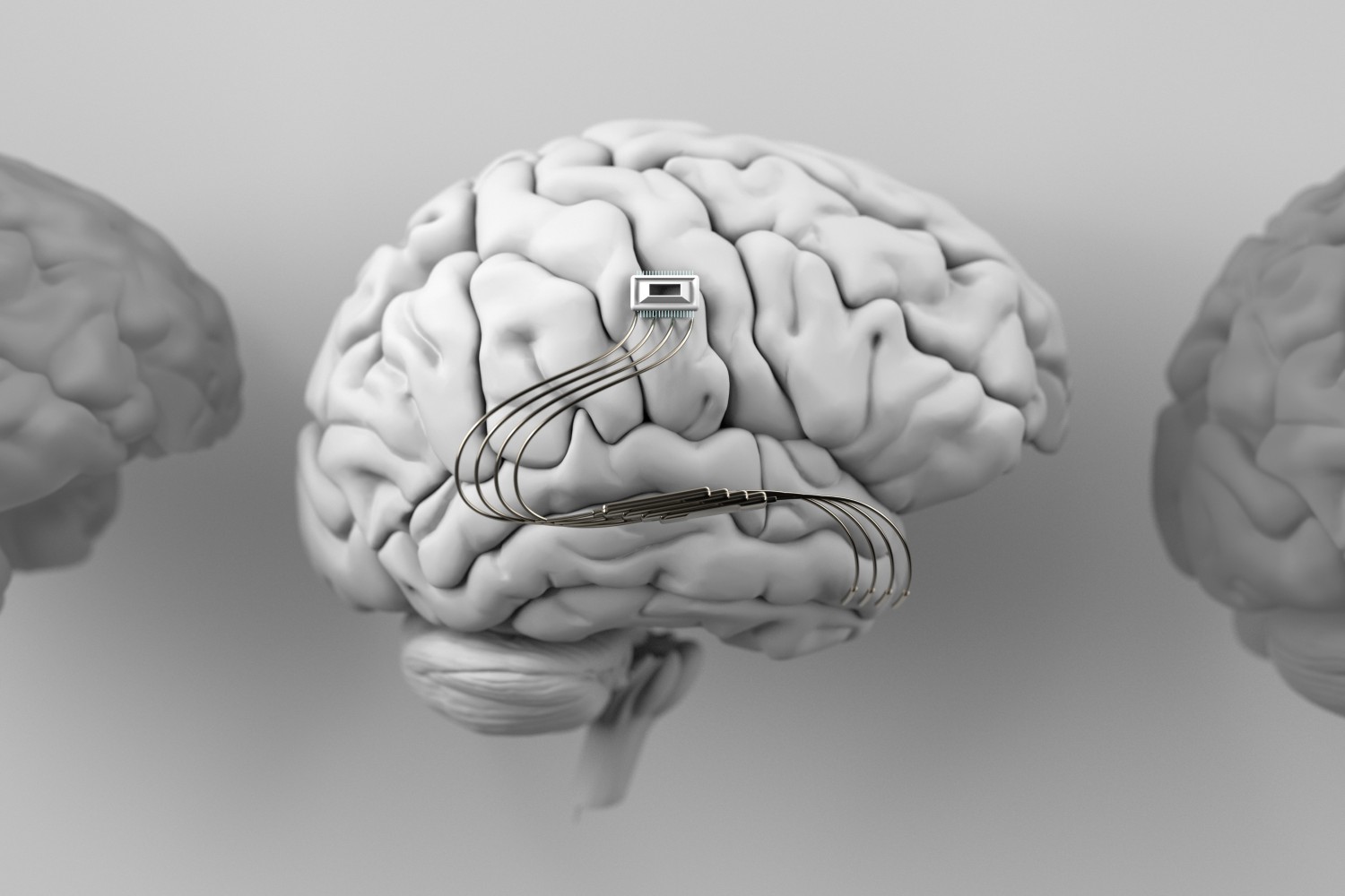 China Makes Brain Implant Technology a Priority - InsideHook